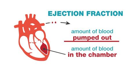 Understanding Regular Ejection Fraction By Age A Complete Information Chart Patterns Cheat
