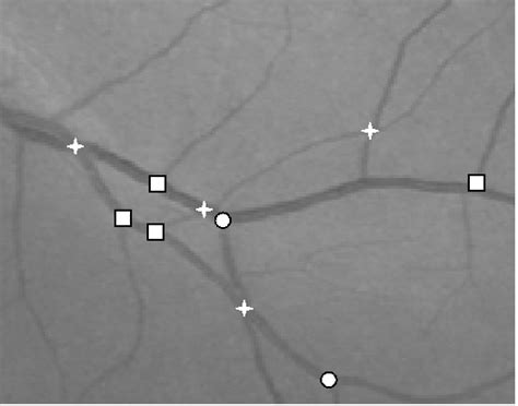 Retinal Vascular Branch Square Bifurcation Circle And Crossover
