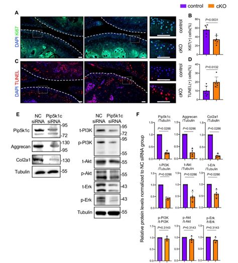 Pip5k1c Loss Inhibits Chondrocyte Proliferation And Induces Chondrocyte