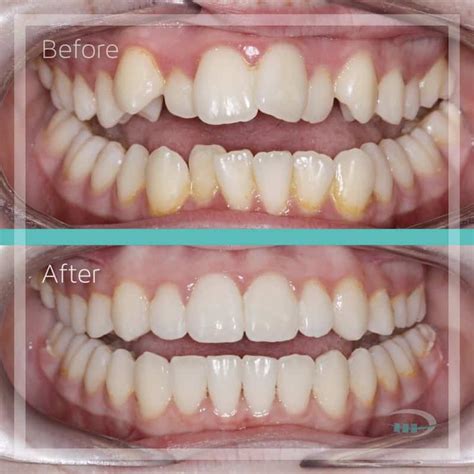 Smile Gallery Hawkesbury Orthodontics