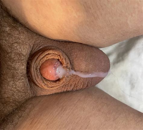 1 Inch Micropenis 7 Pics Xhamster