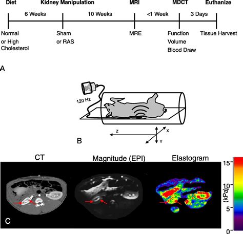 Magnetic Resonance Elastography Noninvasively Detects In Viv Investigative Radiology