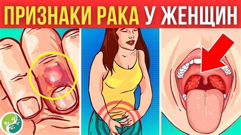 10 ТРЕВОЖНЫХ Признаков Рака Которые Женщины Часто ИГНОРИРУЮТ Вы в группе риска ⚠️ Youtube