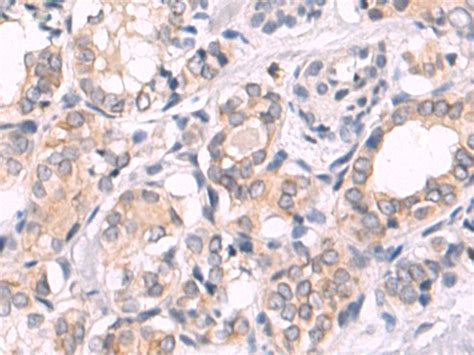 兔抗col1a2多克隆抗体anti Col1a2 Rabbit Polyclonal Antibody 生命科学产品与技术服务 生工生物工程