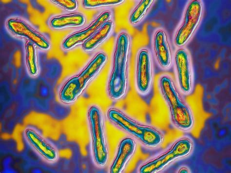 Botulisme Bij Wecken Hoe Gevaarlijk Is Het Echt Weckenonlineeu