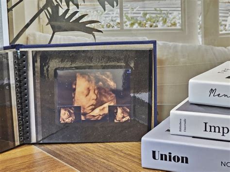 인공수정 시험관 시술 과정 차이 시험관 배아 이식후 증상 W 체외수정 네이버 블로그