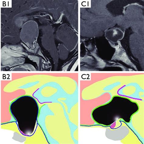 Classification Of CPs Based On Origin Location A Several Possible Download Scientific