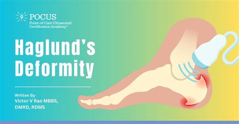 Haglunds Deformity Point Of Care Ultrasound Certification Academy