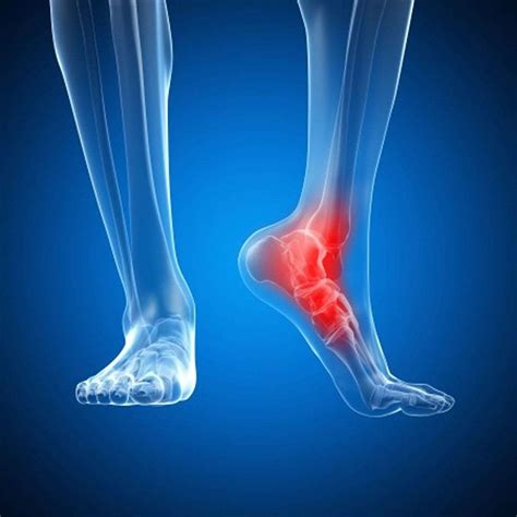 Foot Pain Causes Symptoms And Effective Treatment