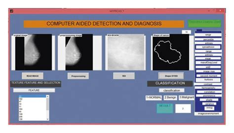 The Proposed CADD System Application Download Scientific Diagram