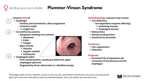 Paterson Kelly Syndrome