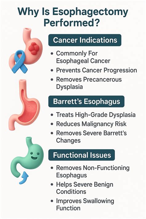 Esophagectomy A Complete Guide To Food Pipe Removal Surgery In India