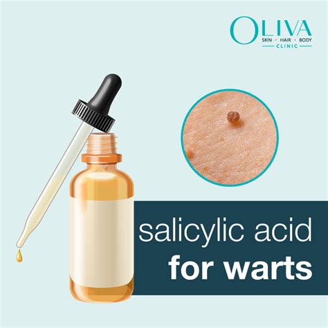 Salicylic Acid For Warts Benefits Side Effects And How To Use