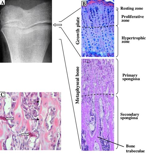 What Type Of Joint Is The Epiphyseal Plate At Christy Sample Blog