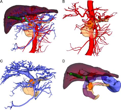 A Preoperative Individual Three Dimensional Visualization Model B