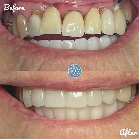 Gables Sedation Dentistry Coral Gables Fl
