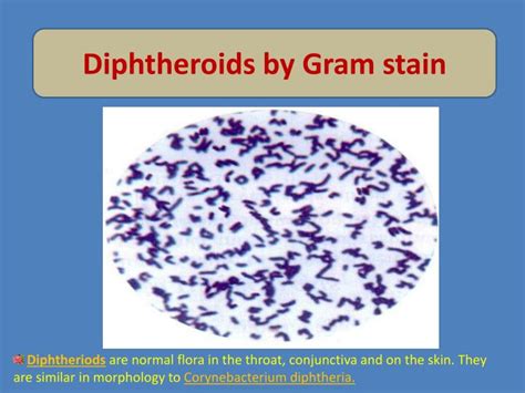 Ppt Corynebacterium Diphtheriae Powerpoint Presentation Id 3672369