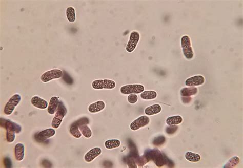 Chromatium Alchetron The Free Social Encyclopedia