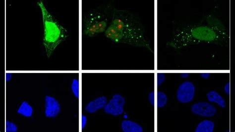 Mystery Of Hepatitis D Life Cycle Revealed Technology Networks