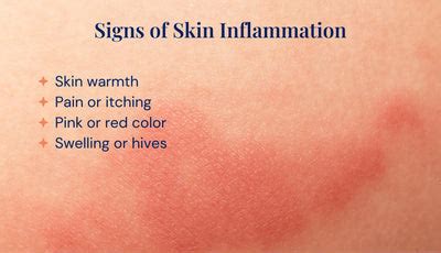 What Is Skin Inflammation Is There A Cure Skin Type Solutions