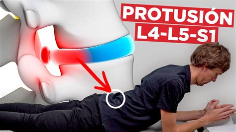 La Guía Definitiva Sobre Cómo Curar La Protusión Discal L5 S1 Consejos