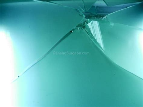 The Glass Appendix Penang Surgeon