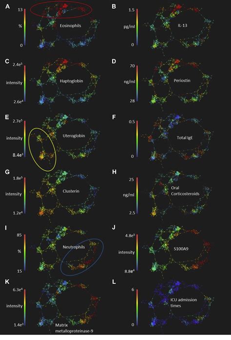 Figure 1 From Stratification Of Asthma Phenotypes By Airway Proteomic