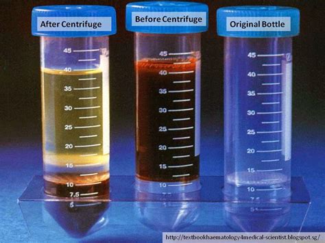 Haematology In A Nutshell July 2014