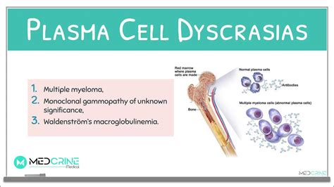 Plasma Cell Disordersdyscrasias Multiple Myeloma Pathology Review