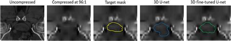 experiment 2 visual results for bladder segmentation using 3d and 3d