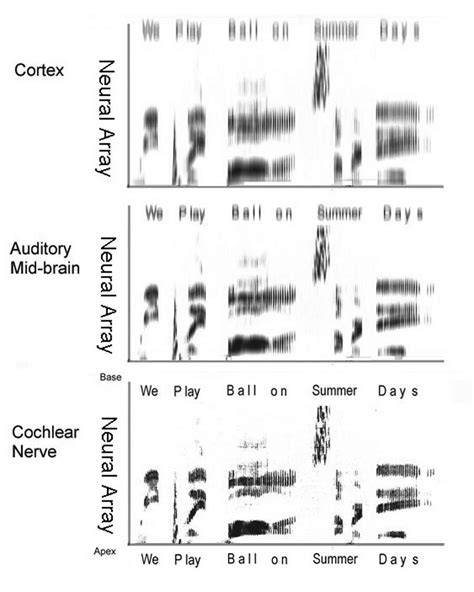 Serves To Illustrate The Task Of The Peripheral Auditory System This