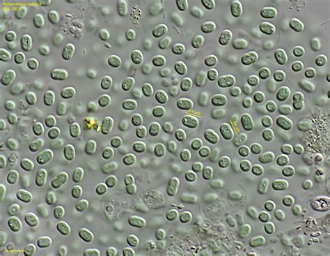 Aphanothece Saxicola Real Micro Life