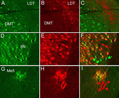 New Article Alert Evaluation Of Egfp Expression In The Chat Egfp