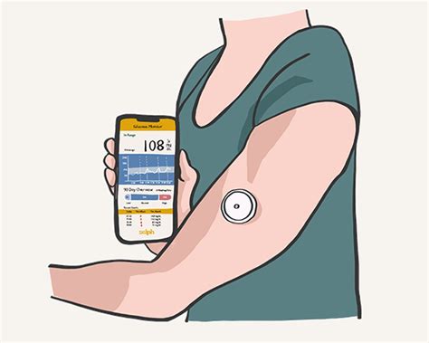 selph cgm and consultation