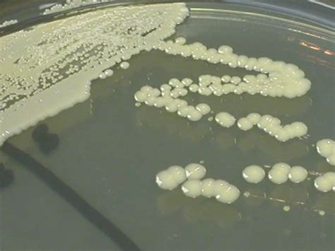 Best Micrococcus Images On Pinterest Microbiology Lab Values And Medical Science