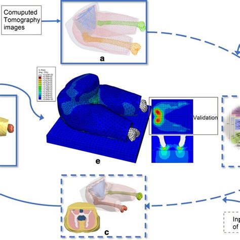process of parametric finite element modeling a reference buttock