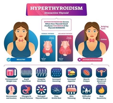 Why Do I Have Thyroid Nodules Rfa For Life Blog