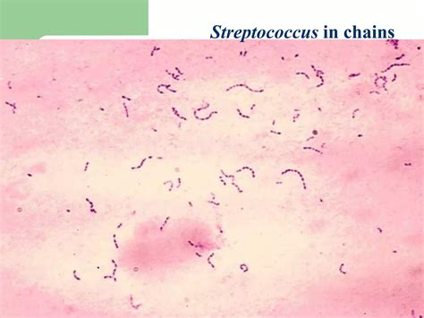 Pneumococcusppt