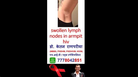 Lymph Nodes Armpit Hiv