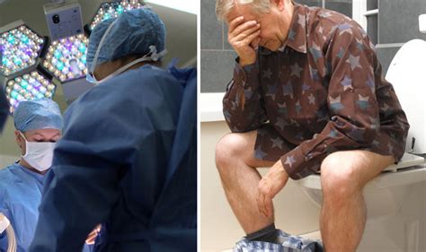 Piles Experts Reveal This Treatment Is Best For Controlling The