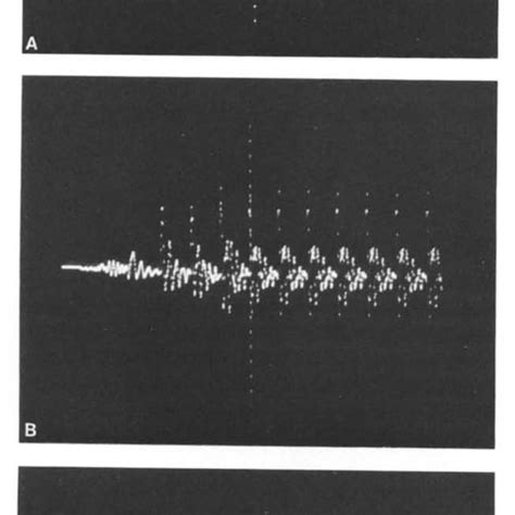 Sample Waveforms As Displayed During Editing A Oscillogram Of The