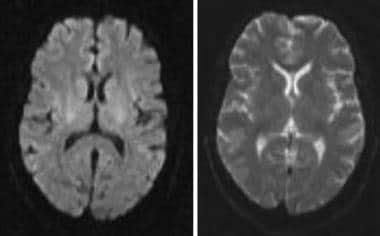 Diffusion Tensor Imaging Practice Essentials Tensor And Diffusion