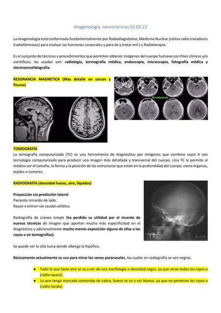 Neuro Udocz Neuro Udocz