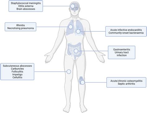 Staphylococcus Aureus Infection