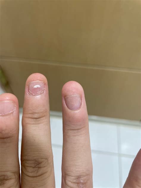 손톱 위 부음 지식in 손톱 위 부음 지식in