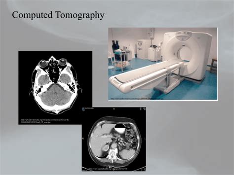 Computed Tomography