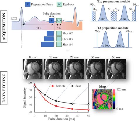 Data Acquisition And Fitting Process In Routine Myocardial Parametric