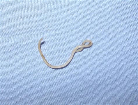 How Do Roundworms Reproduce