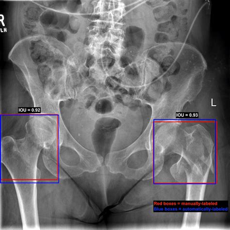 Manual Versus Automated Bounding Box Placement On An Image From Our