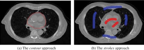 two designed interactive segmentation approaches download scientific